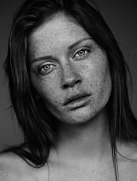 11 Stunning Portraits That Show Just How Beautiful Freckles Are