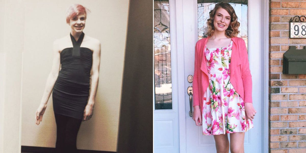 Transgender People Are Sharing The Most Lovely Photos Of Their Transitions