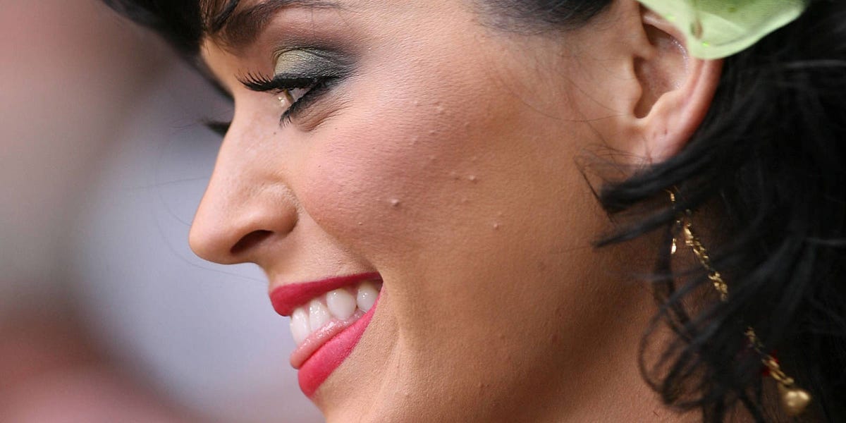 The Difference Between Hormonal And Cystic Acne