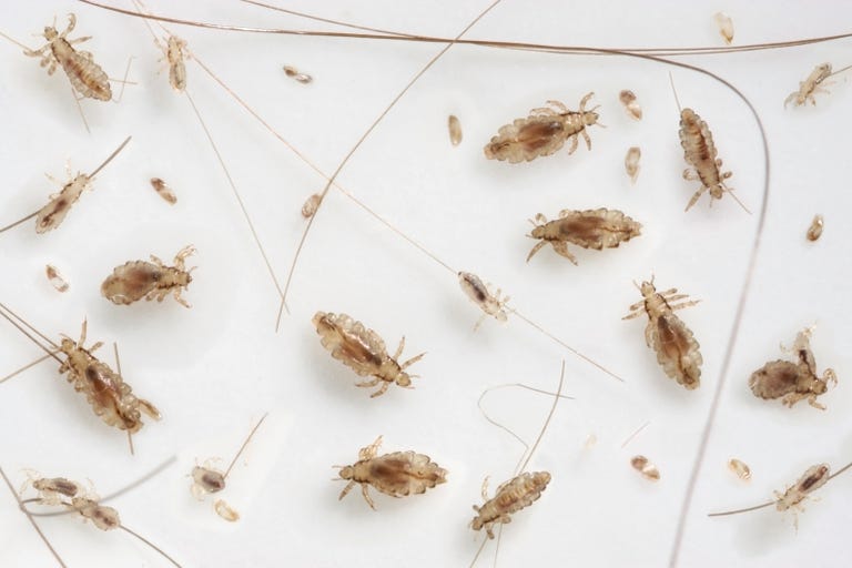 How To Get Rid Of Lice Head Lice Treatments And Home Remedies That Work