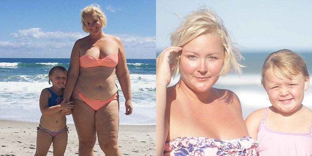 Mom Explains Stretch Marks To Daughter Women S Health