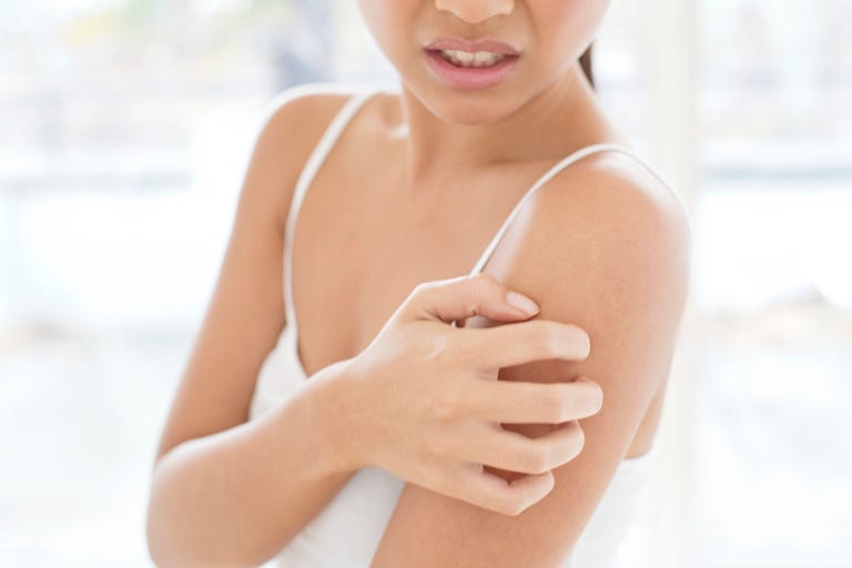 Stress Rash What Does It Look Like How Do You Treat It