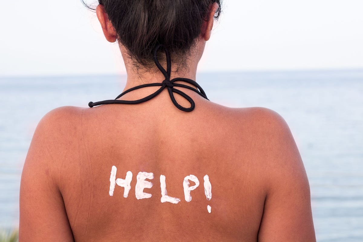 9 Sunburn Relief Tricks That Work How To Soothe A Burn