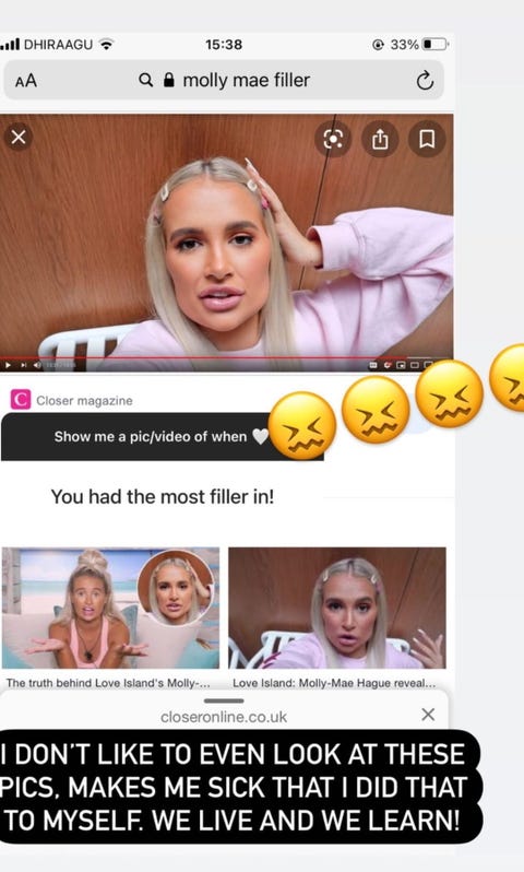 Love Islands Molly Mae Hague Admits Lip Filler Regret