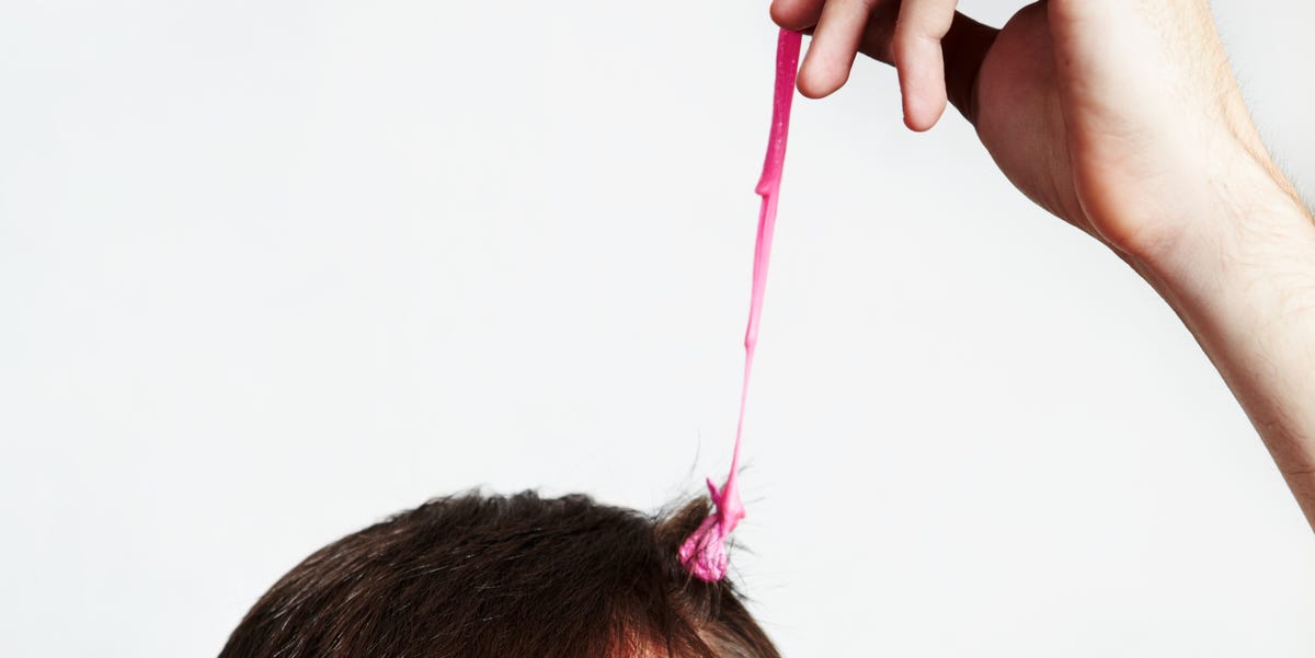Dr Pimple Popper Pops Bubble Gum Cyst Stuck In A Womans Hair