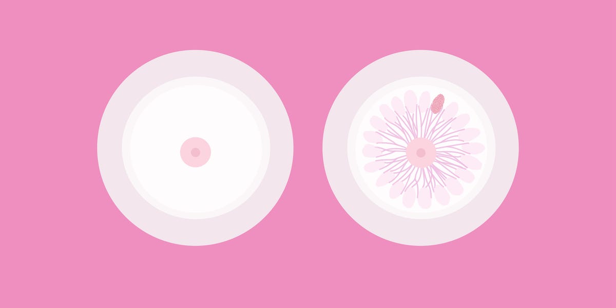 Understanding Breast Cancer Stages And Their Importance In Prognosis