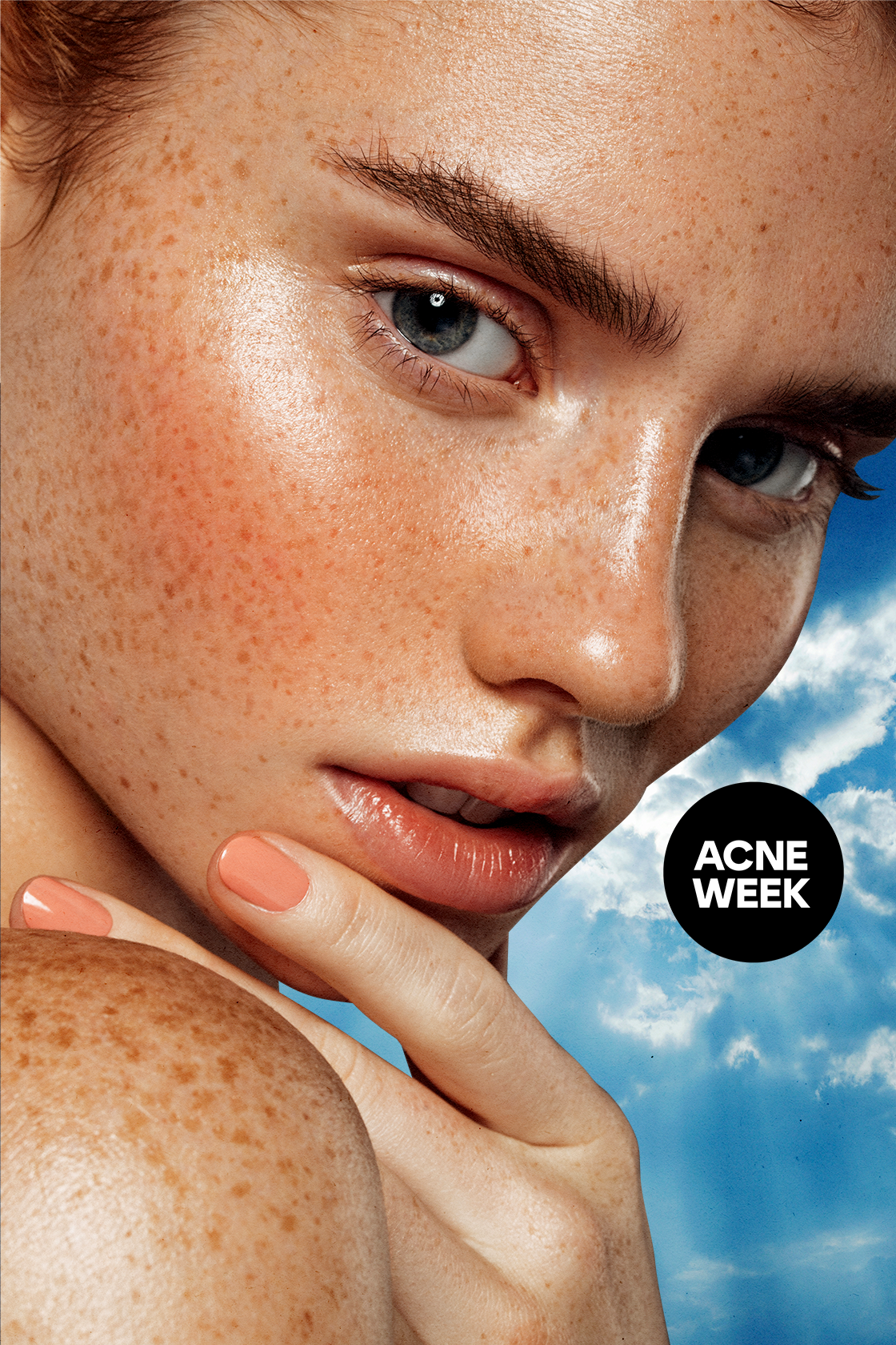 Can You Manifest Clear Skin Experts Weigh In