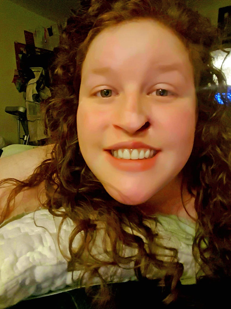 A Spot On This Womans Nose Turned Out To Be Cancer