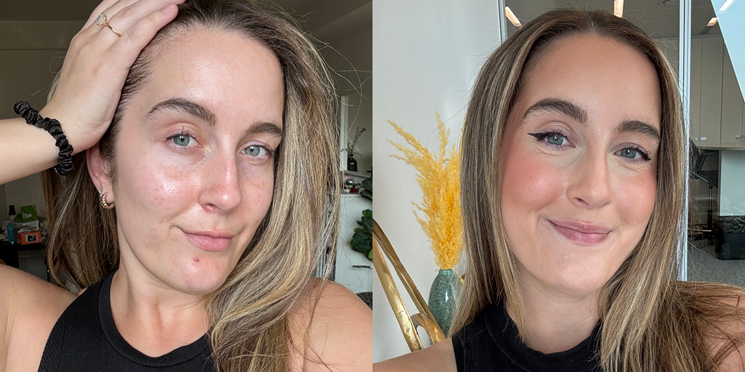 I Just Got My First Chemical Peel At Massage Envy And My Skin Looks Radiant Af