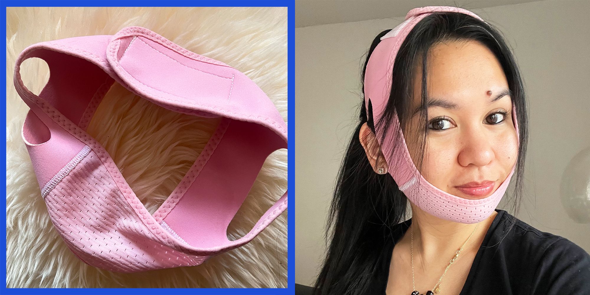 I Wore A Chin Strap To Bed For Ten Days See Photos