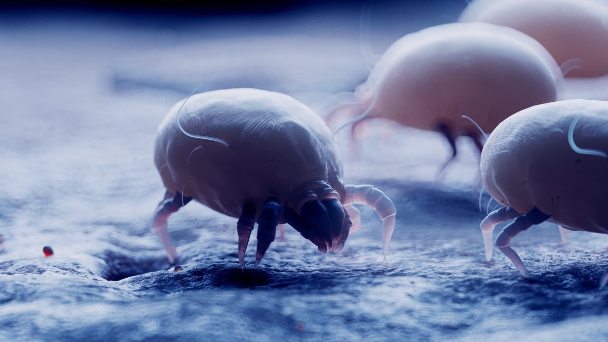 Dust Mite Bites Symptoms Allergy Treatment Prevention