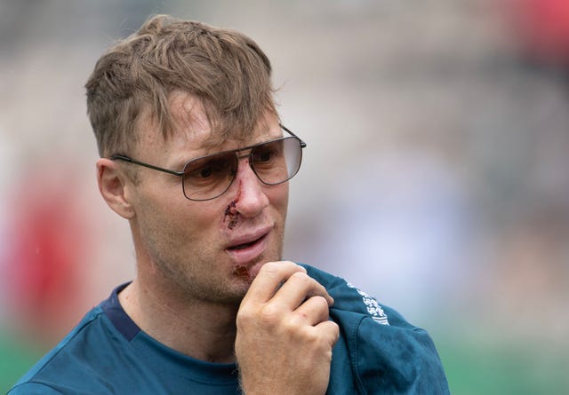 Former Top Gear Host Andrew Flintoff Says On Set Crash Left Him With