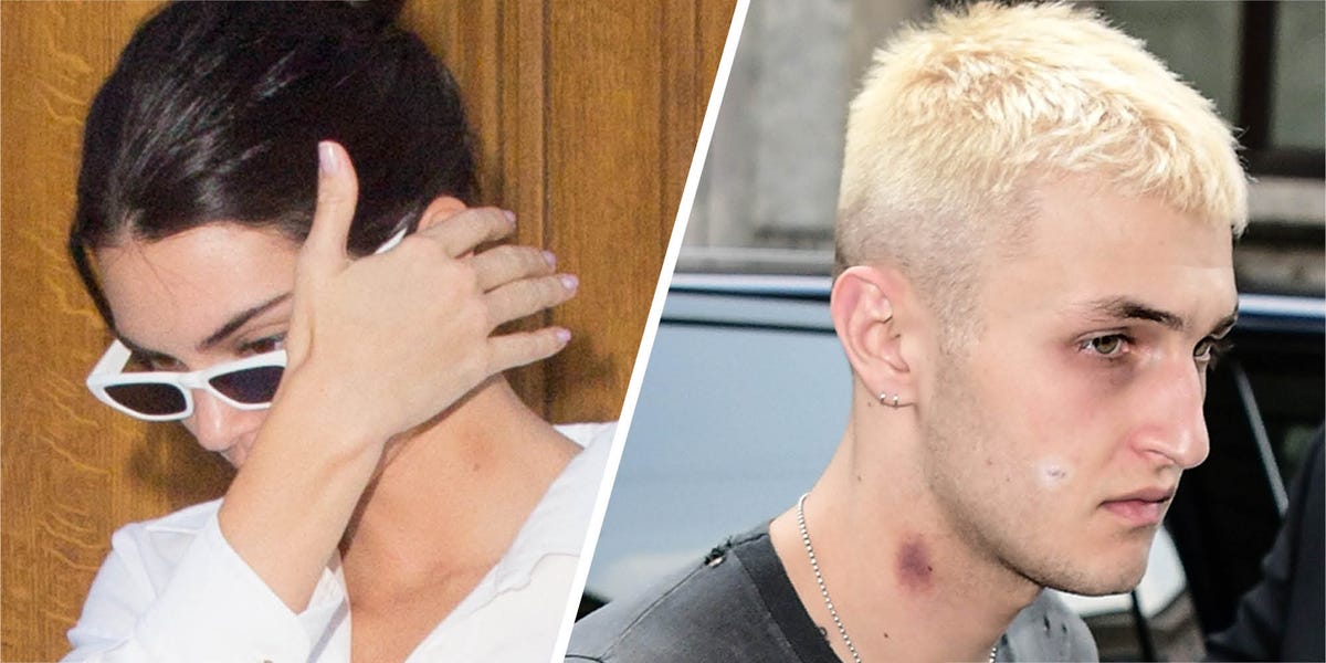 Kendall Jenner And Anwar Hadid Appear To Have Matching Love Bites So