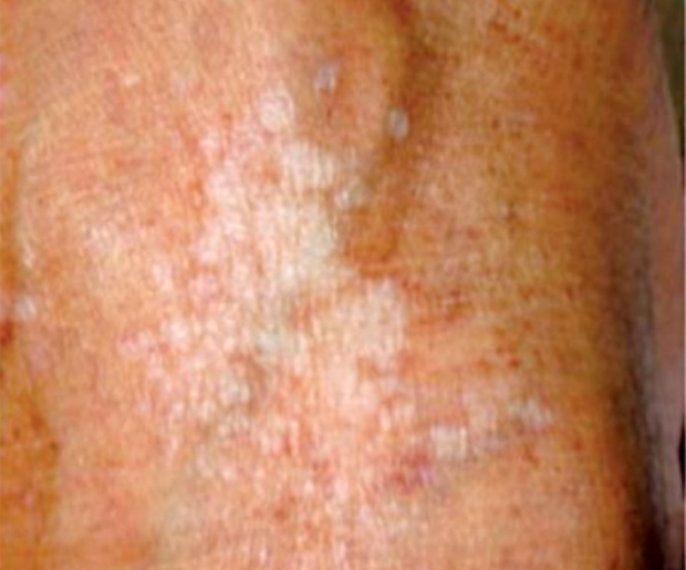 Skin Conditions On Vagina Womens Health
