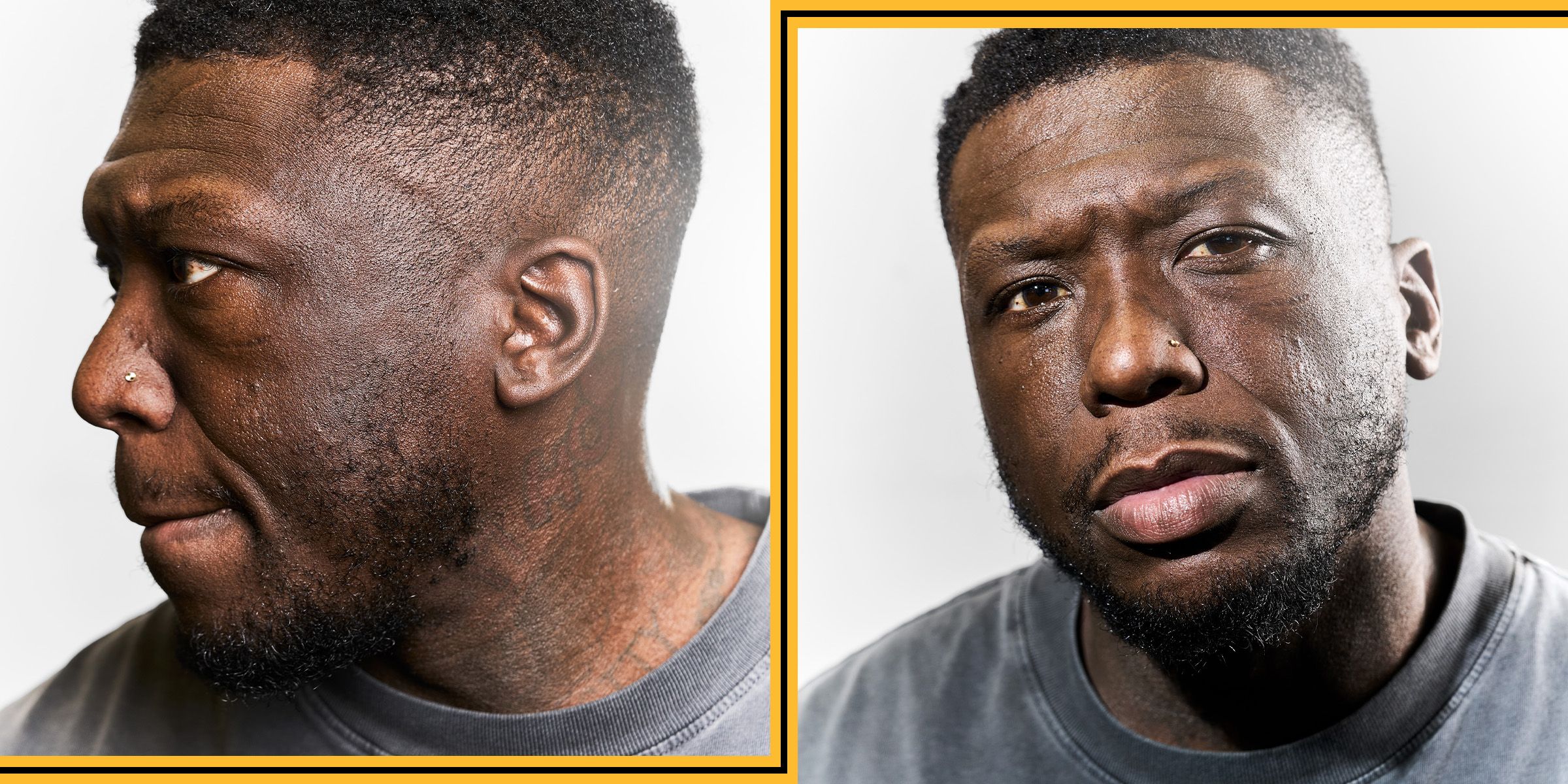 Nate Robinson Talks Dialysis Kidney Failure Search for Kidney