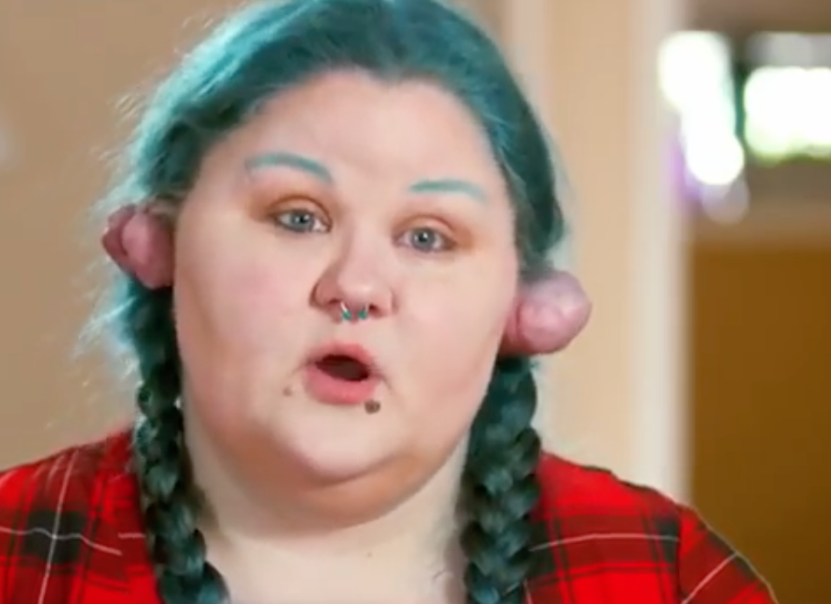 Dr Pimple Popper Tackles Huge Ear Keloids In Season 3 Premiere