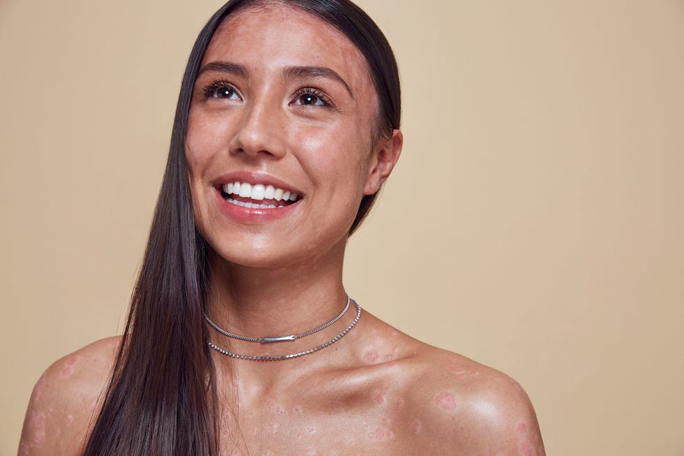Missguided Launches A Stunning Body Positive Campaign Inyourskin