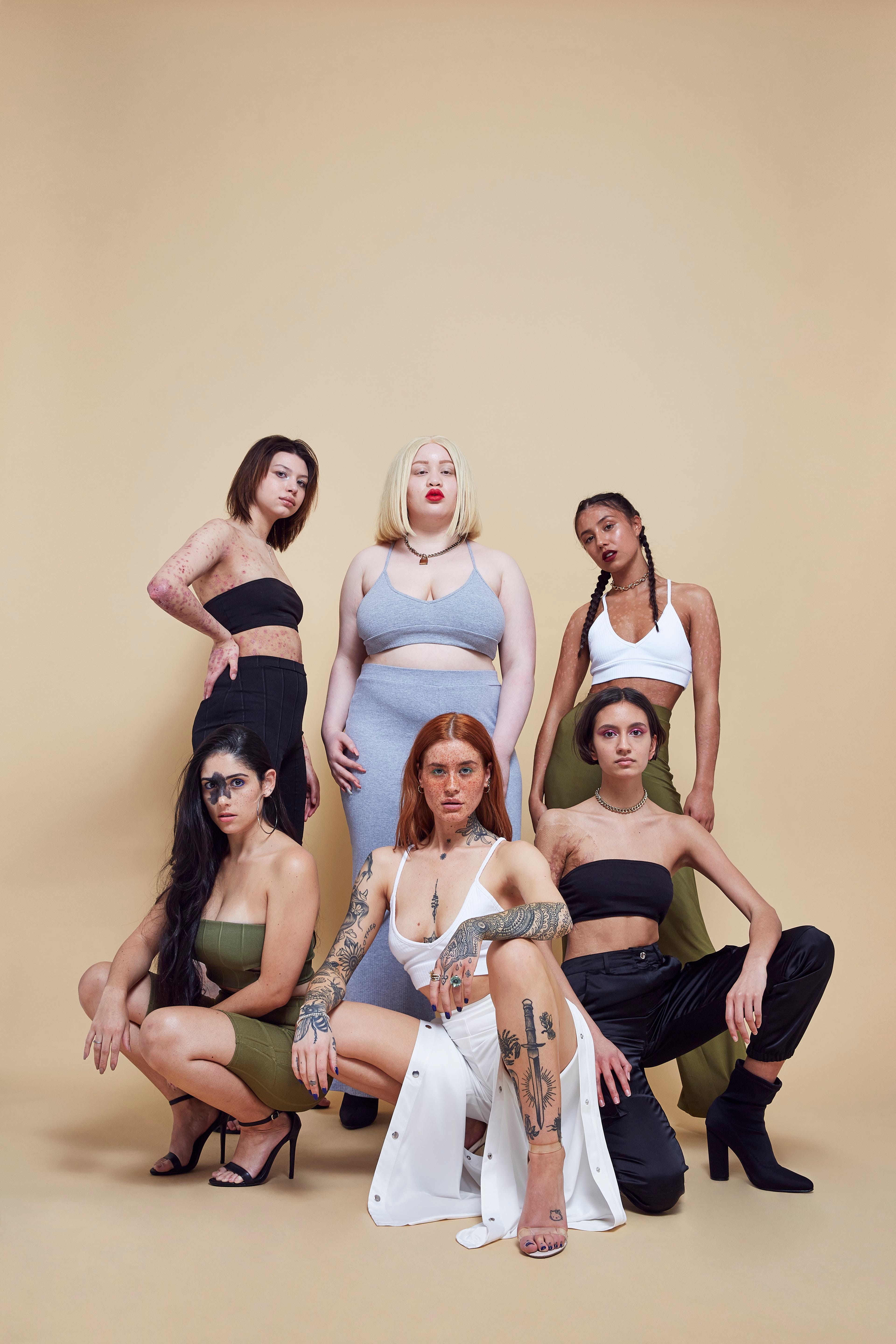 Missguided Launches A Stunning Body Positive Campaign Inyourskin