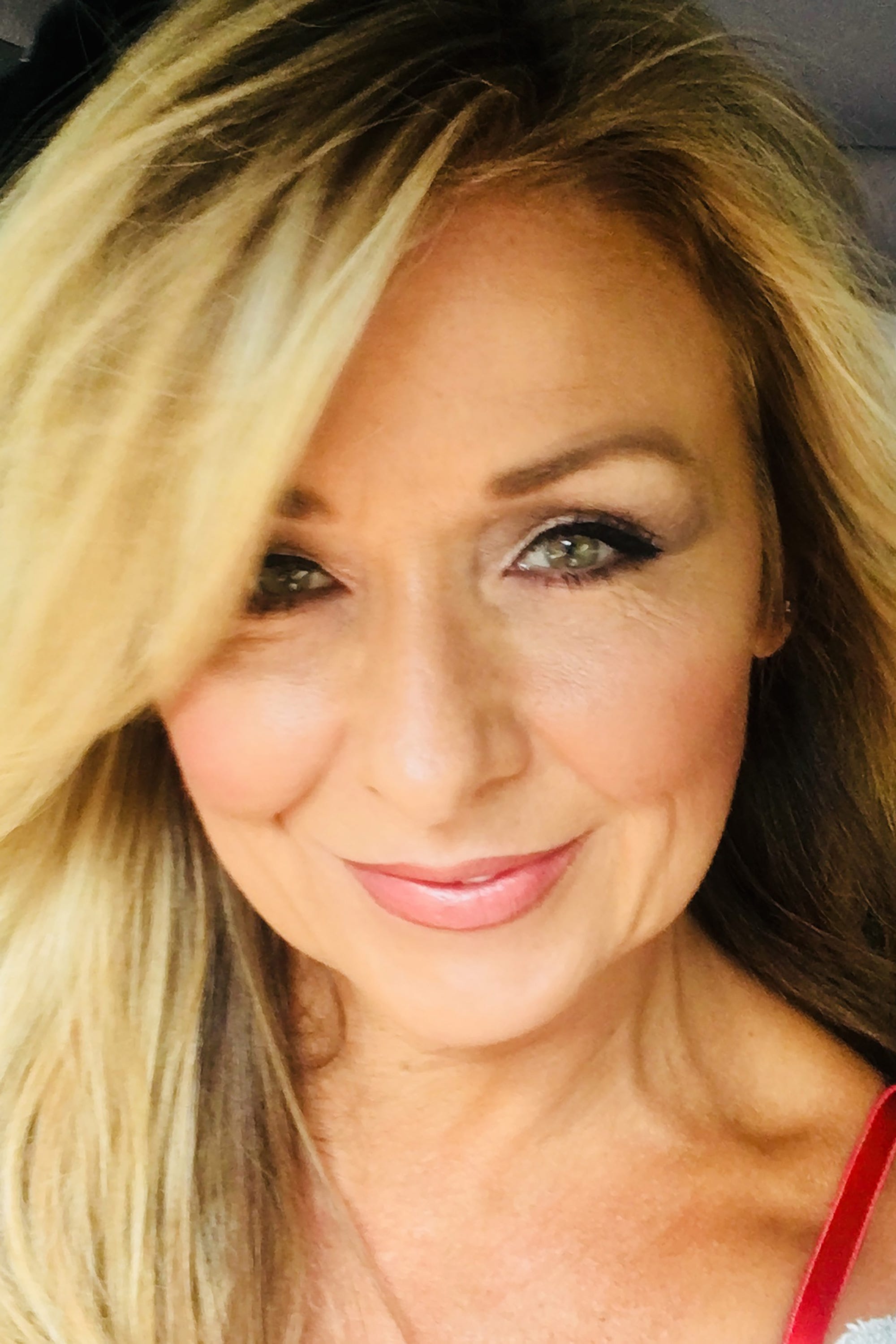 Woman Who Didnt Remove Her Mascara At Night Has Terrifying Discovery Inside Her Eyelid