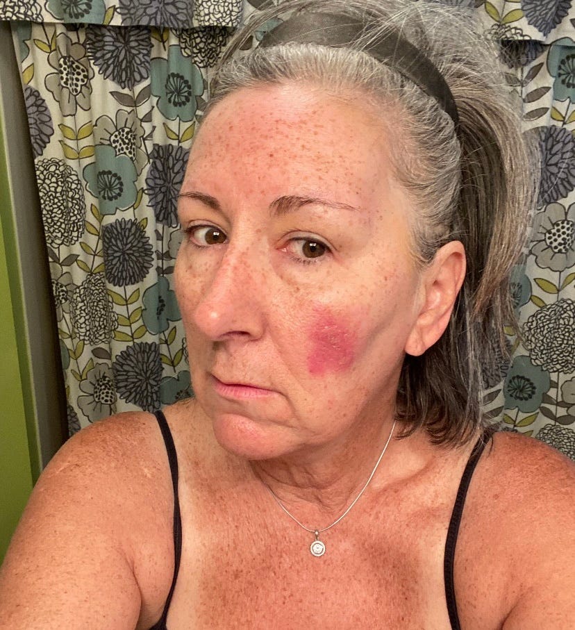 26 Pictures Of Skin Rashes—what Common Skin Rashes Look Like
